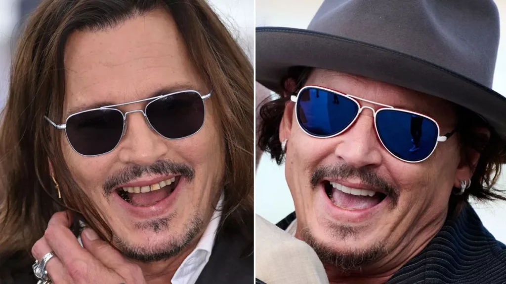 Johnny Depp Teeth : The Shocking 2026 Transformation Before & After