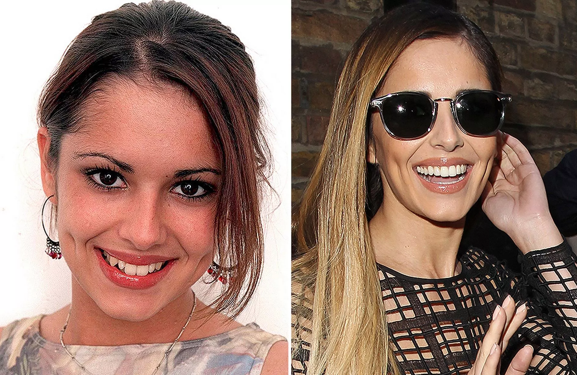 Cheryl Cole Teeth: Secrets of Her Stunning $50,000 Smile Transformation