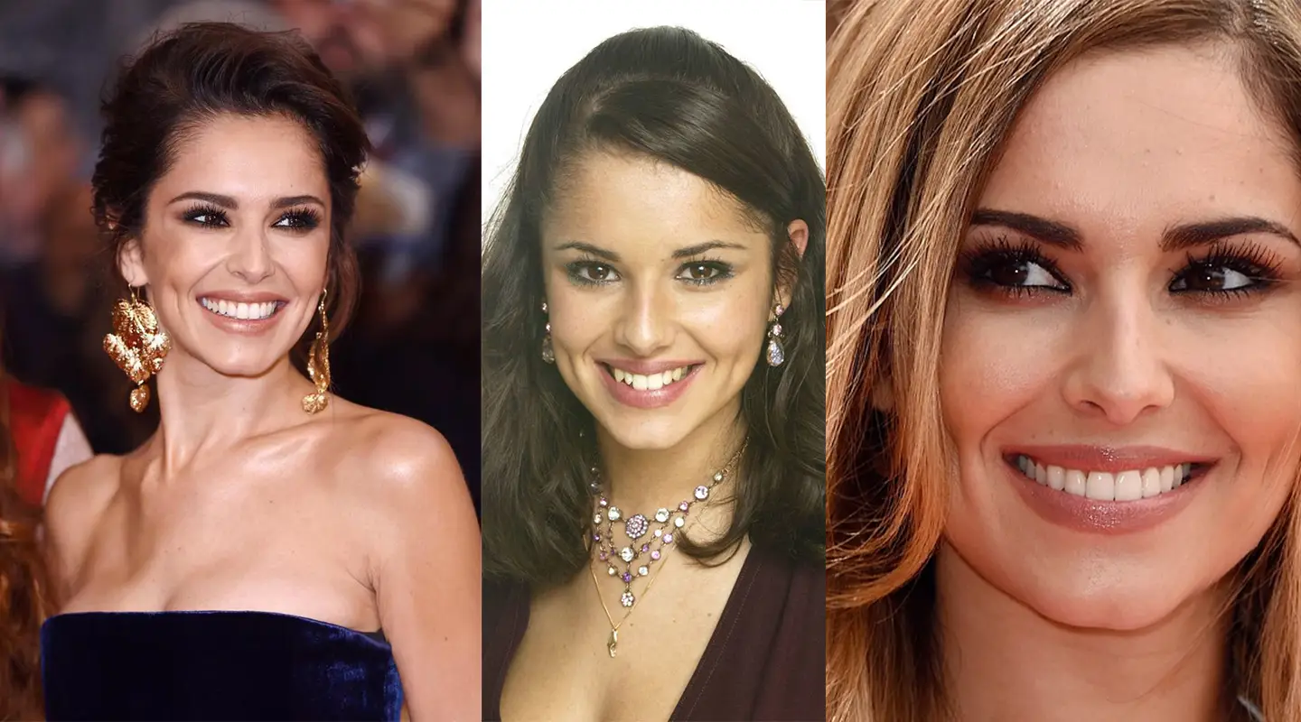 Cheryl Cole Teeth: Secrets of Her Stunning $50,000 Smile Transformation