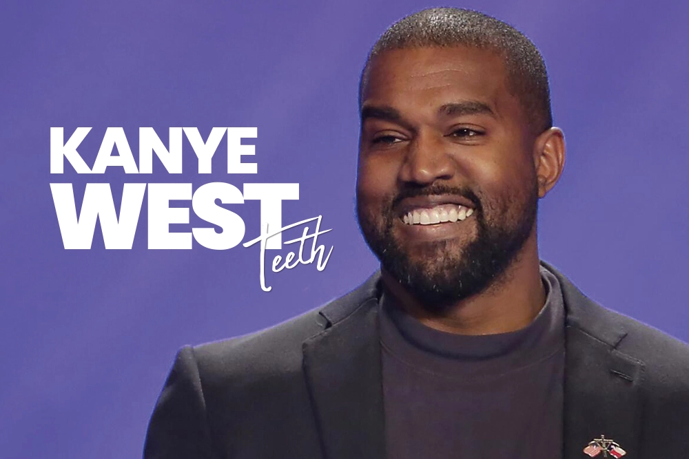 Kanye West Teeth: The $850K Titanium Transformation & Dental Secrets