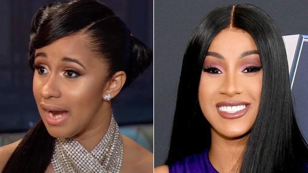 Cardi B Teeth: The Ultimate 2026 Transformation Review & Analysis