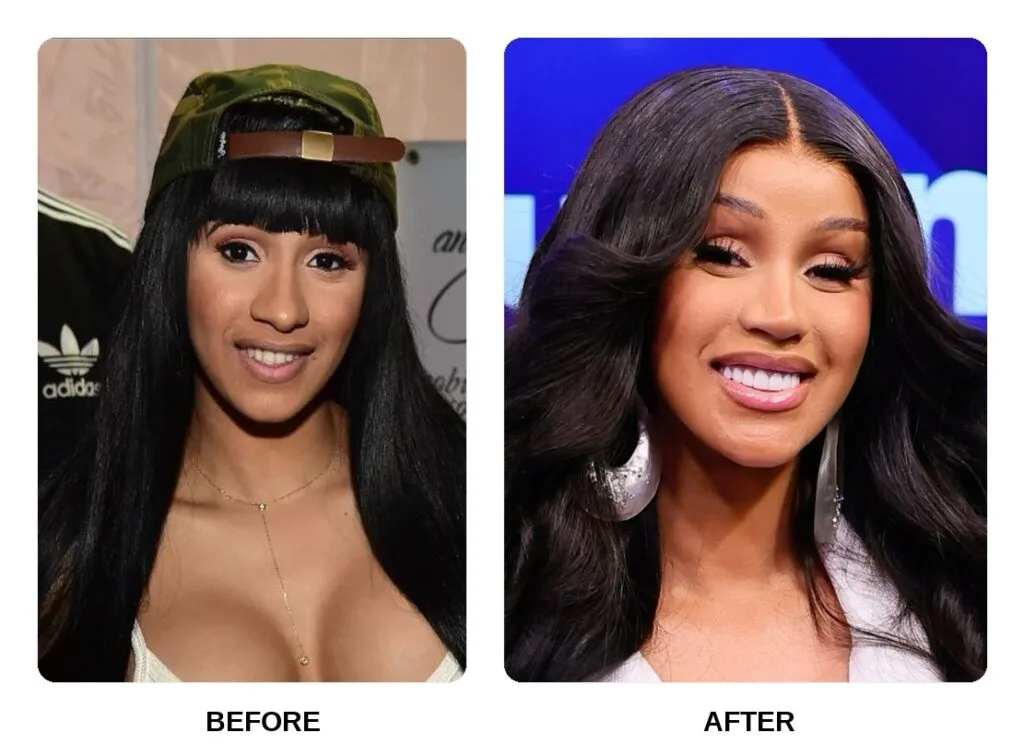 Cardi B Teeth: The Ultimate 2026 Transformation Review & Analysis