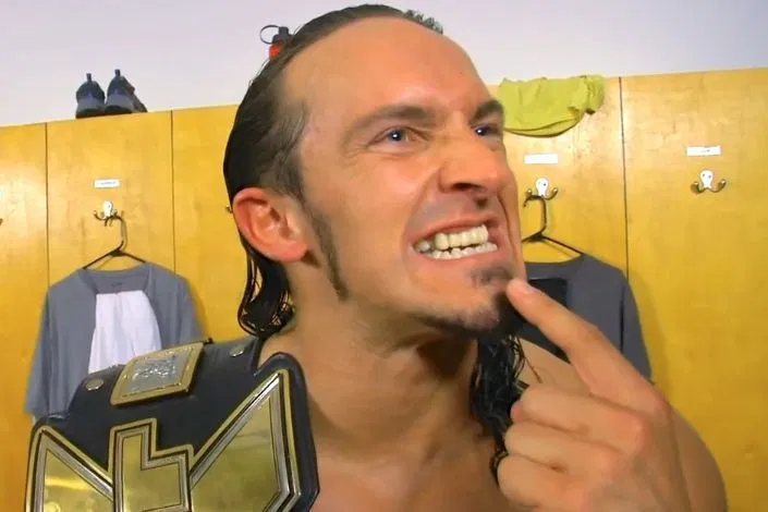 Jeff Hardy Teeth: A Comprehensive Review of the Enigmatic Enigma’s ...
