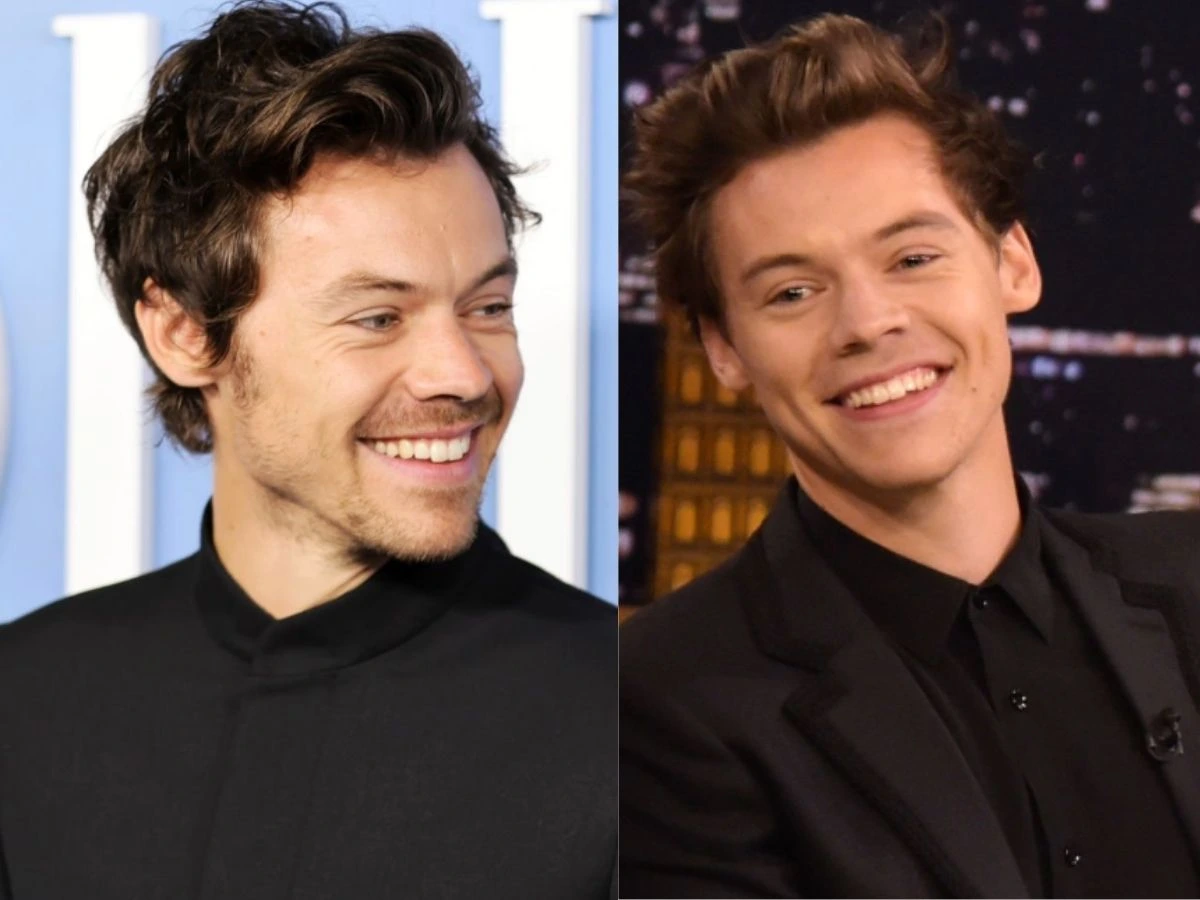 Harry Styles Teeth: A Comprehensive Review of His Dental Transformation ...
