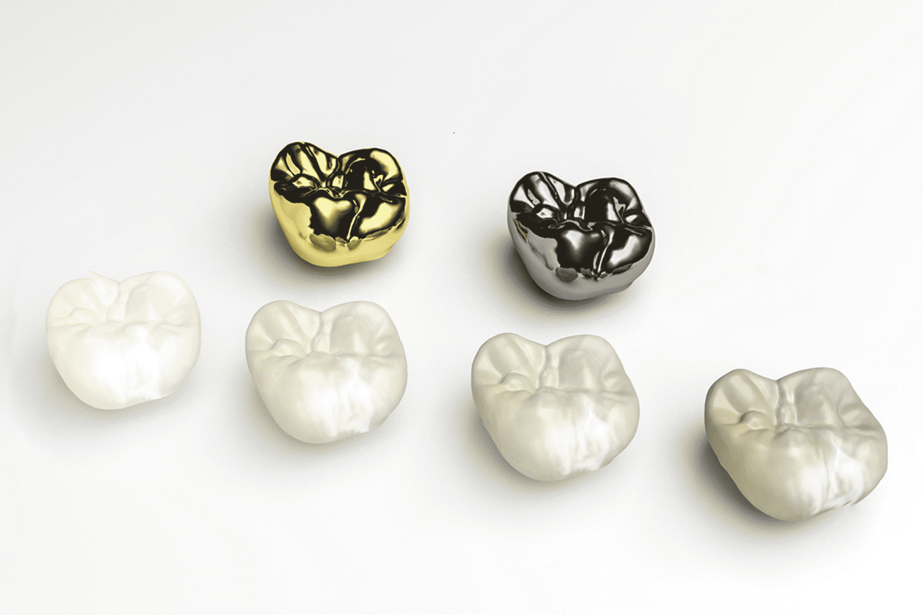 Dental Post and Core Cost Turkey: Your 2026 Guide to Pivot Teeth