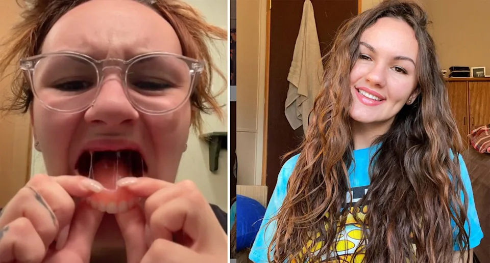 Faith Hill Teeth: A Clinical Review of the Viral TikTok Smile Makeover