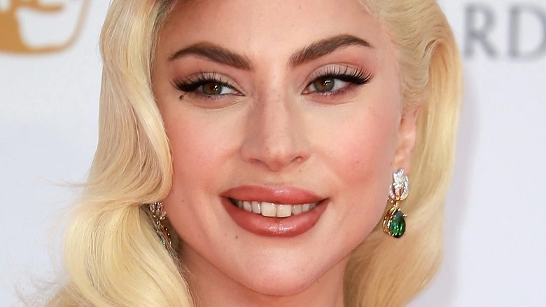 Lady Gaga Teeth: The Ultimate Review of Her Dental Transformation (2005 ...