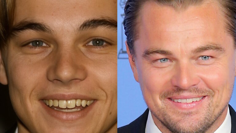 Leonardo DiCaprio Teeth: The Secret Behind His Hollywood Smile Evolution