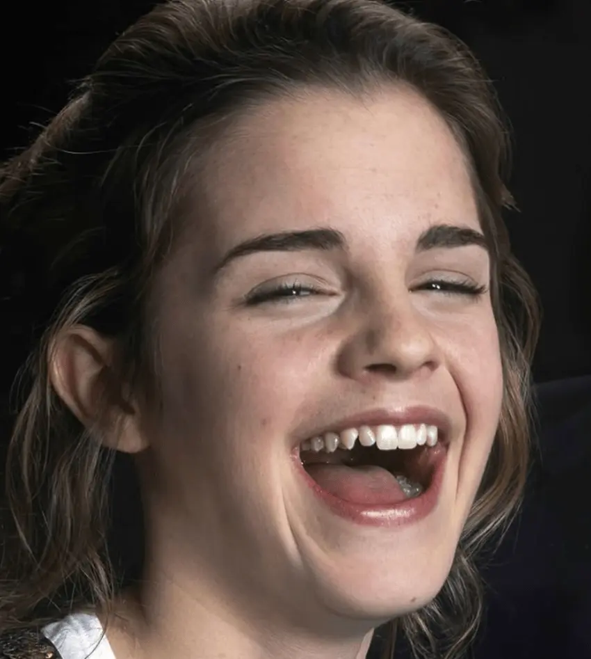 Emma Watson Teeth : The Ultimate Evolution of the Hermione Smile