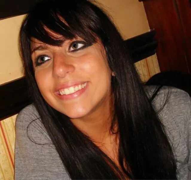 Lady Gaga Teeth: The Ultimate Review of Her Dental Transformation (2005 ...