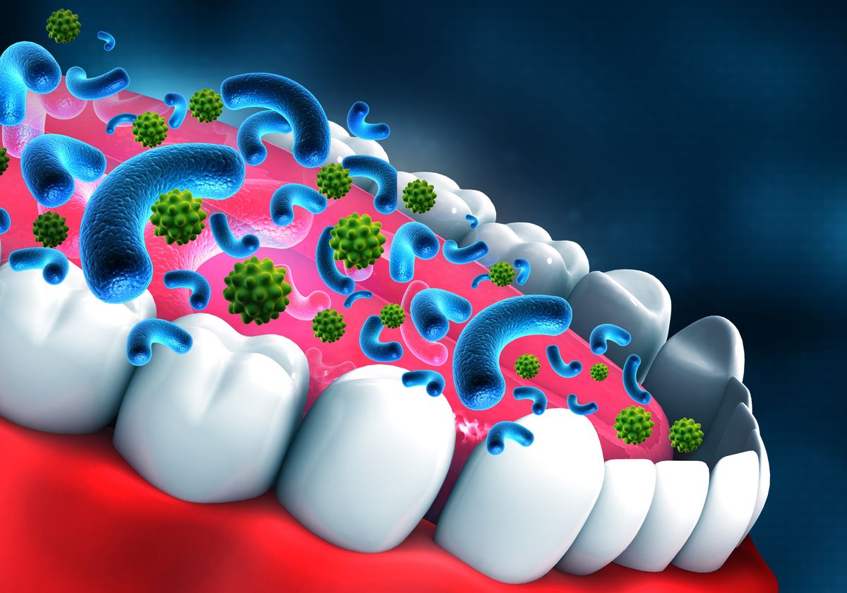 Saignement des gencives et microbiome : 5 causes cachées et solutions 2026