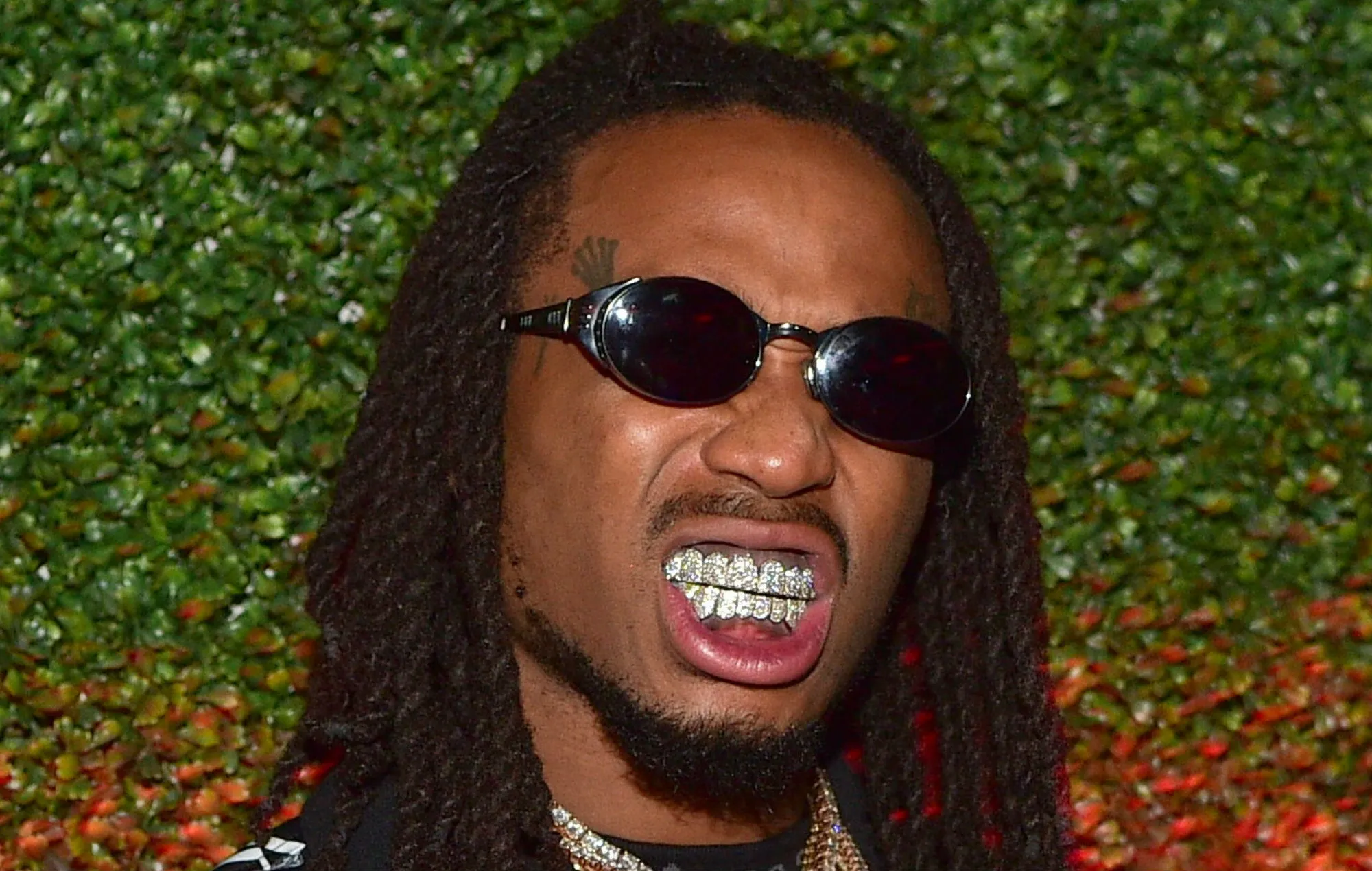 Quavo Migos Teeth: The $250K Dental Transformation and Expert Review