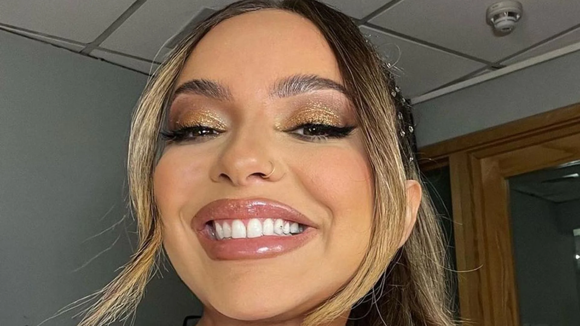 Jade Thirlwall Teeth Transformation: Before and After Veneers ...