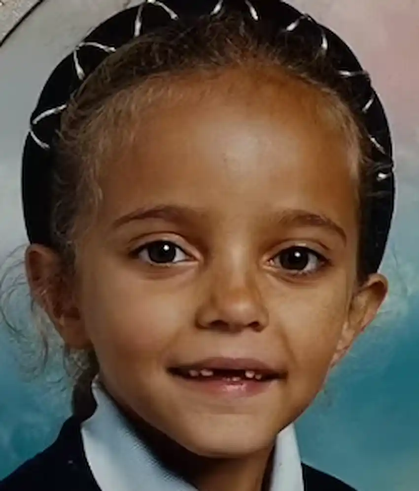 Jade Thirlwall Teeth Transformation: Before and After Veneers ...