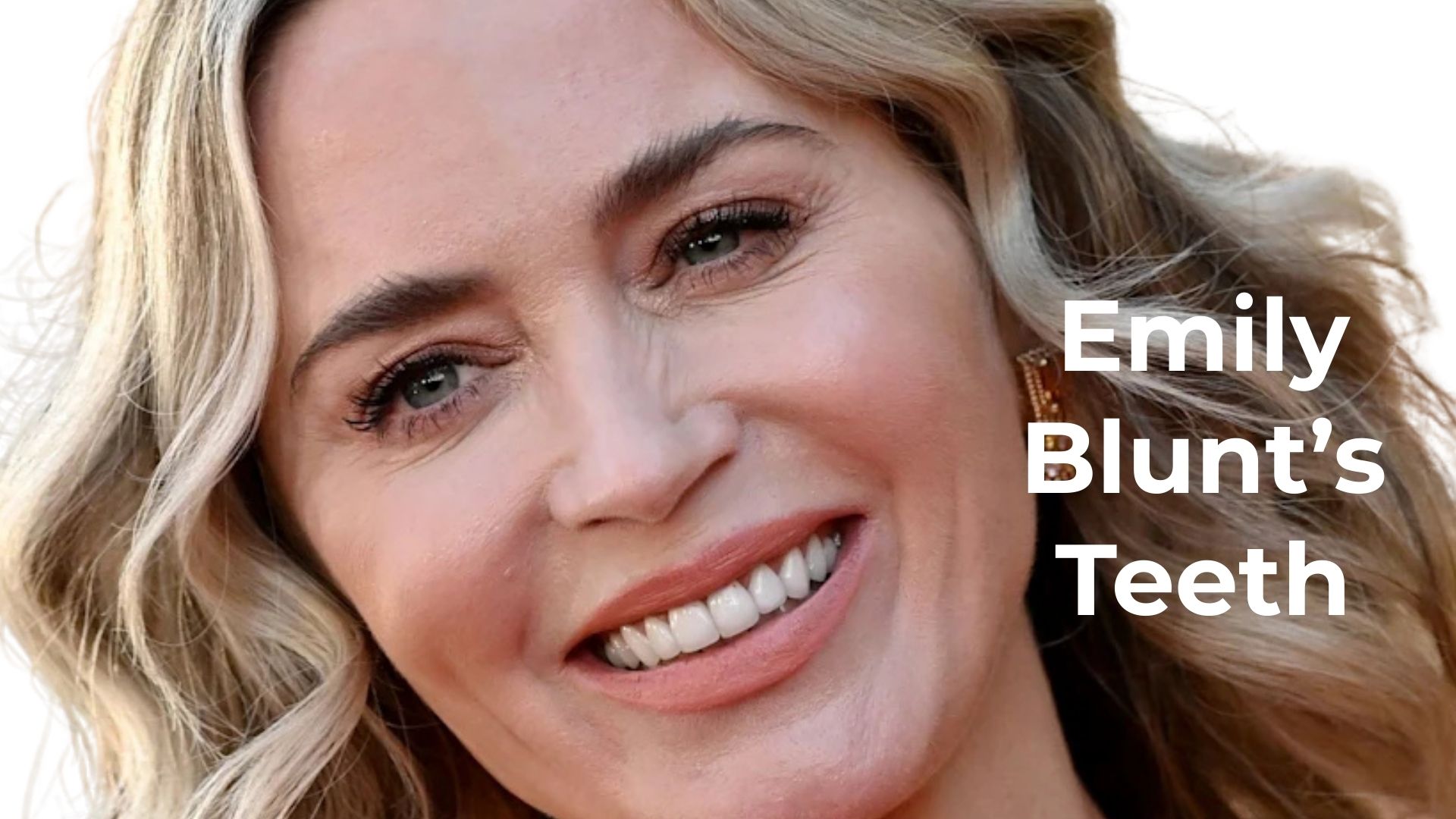 Emily Blunt Teeth 2026: Ultimate Before & After Dental Review | Expert ...
