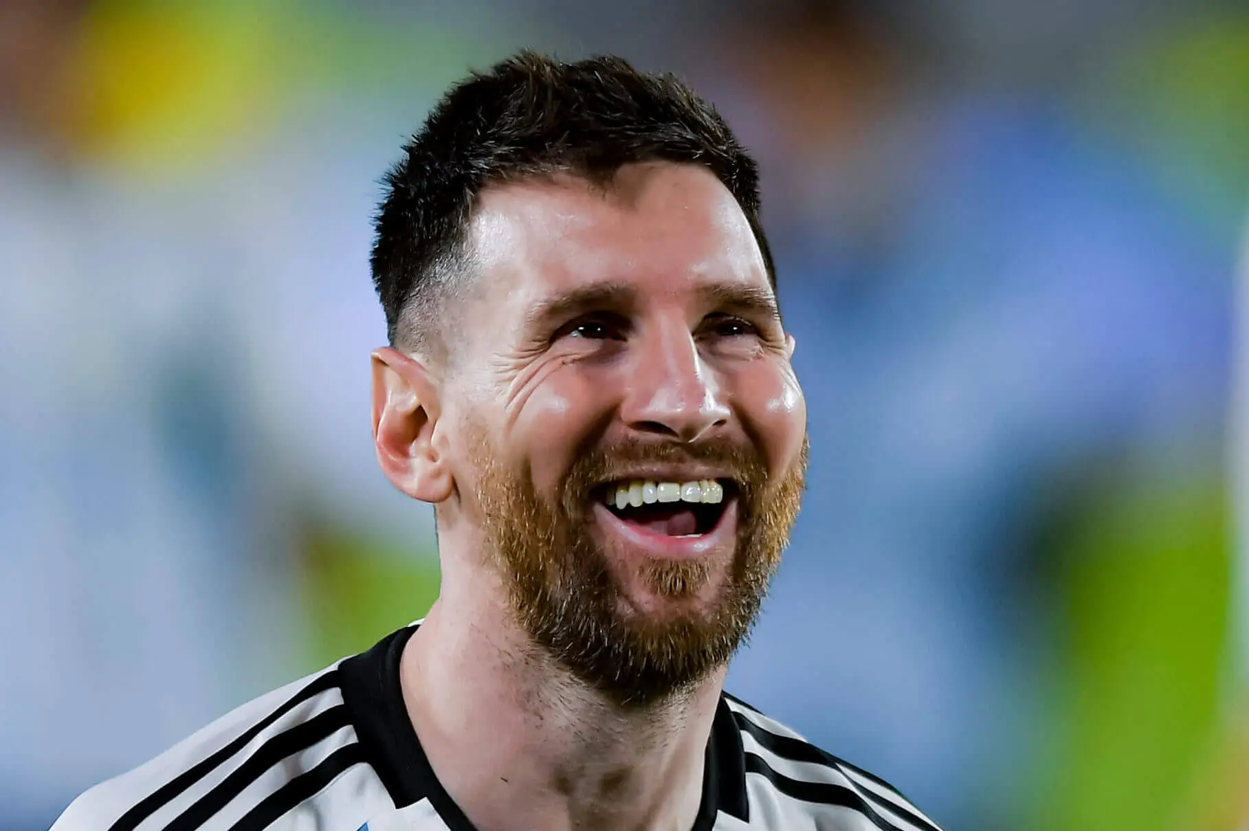Lionel Messi Teeth Before and After 2026: The Ultimate Dental Review of ...