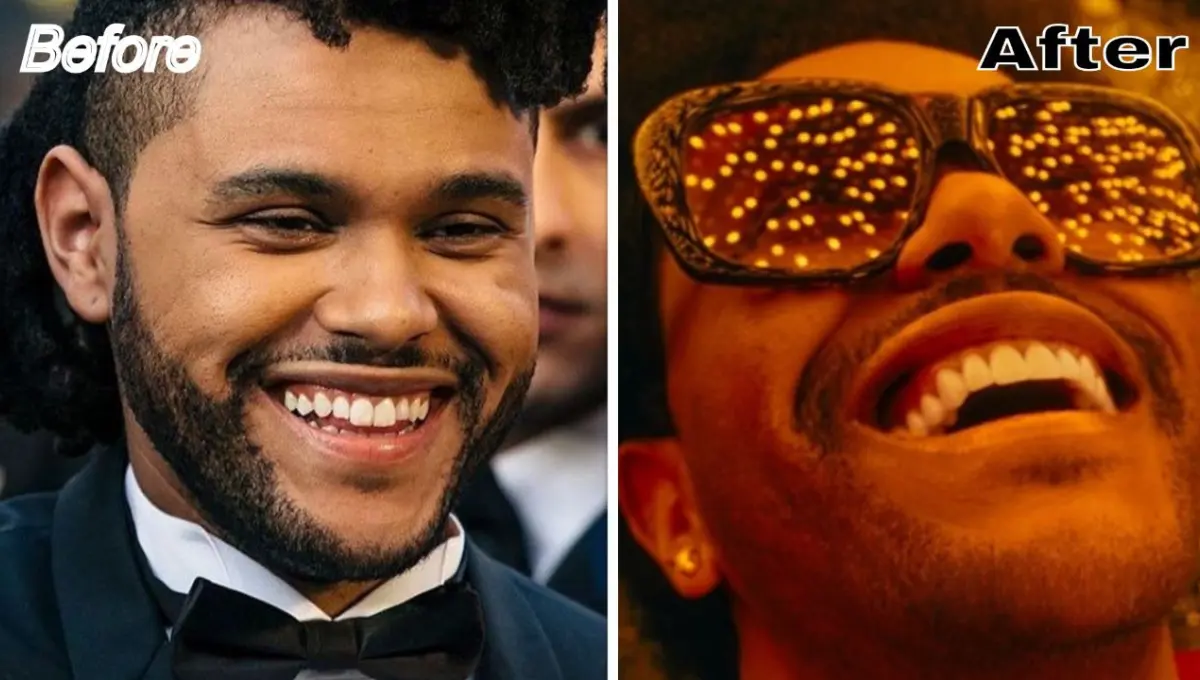 The Weeknd Teeth: 2026 Dental Transformation Review | Before & After ...